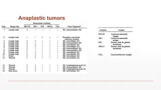 Tumor Immunology and role of antigens in analysis of anaplastic tumors ...