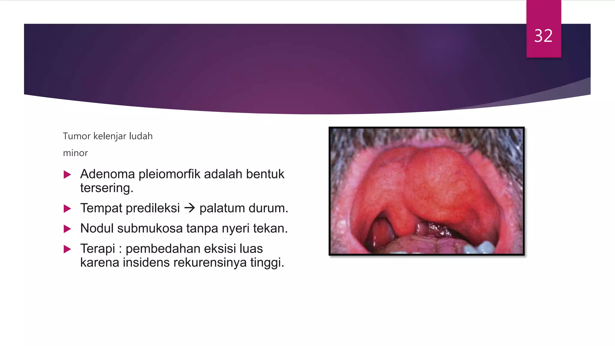 Lidah dan Rongga Mulut.pptx