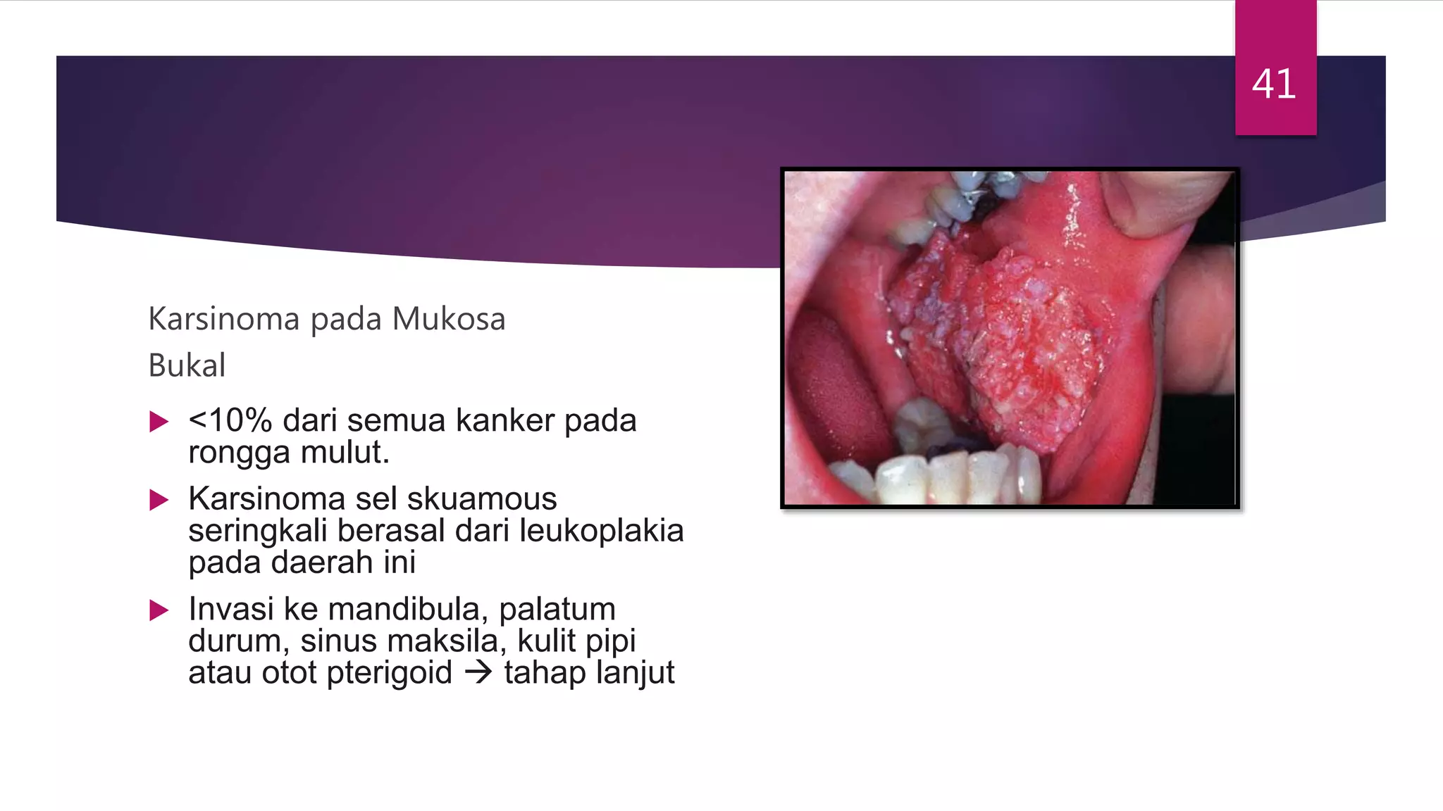 Lidah dan Rongga Mulut.pptx