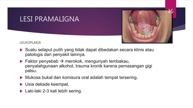 Lidah dan Rongga Mulut.pptx