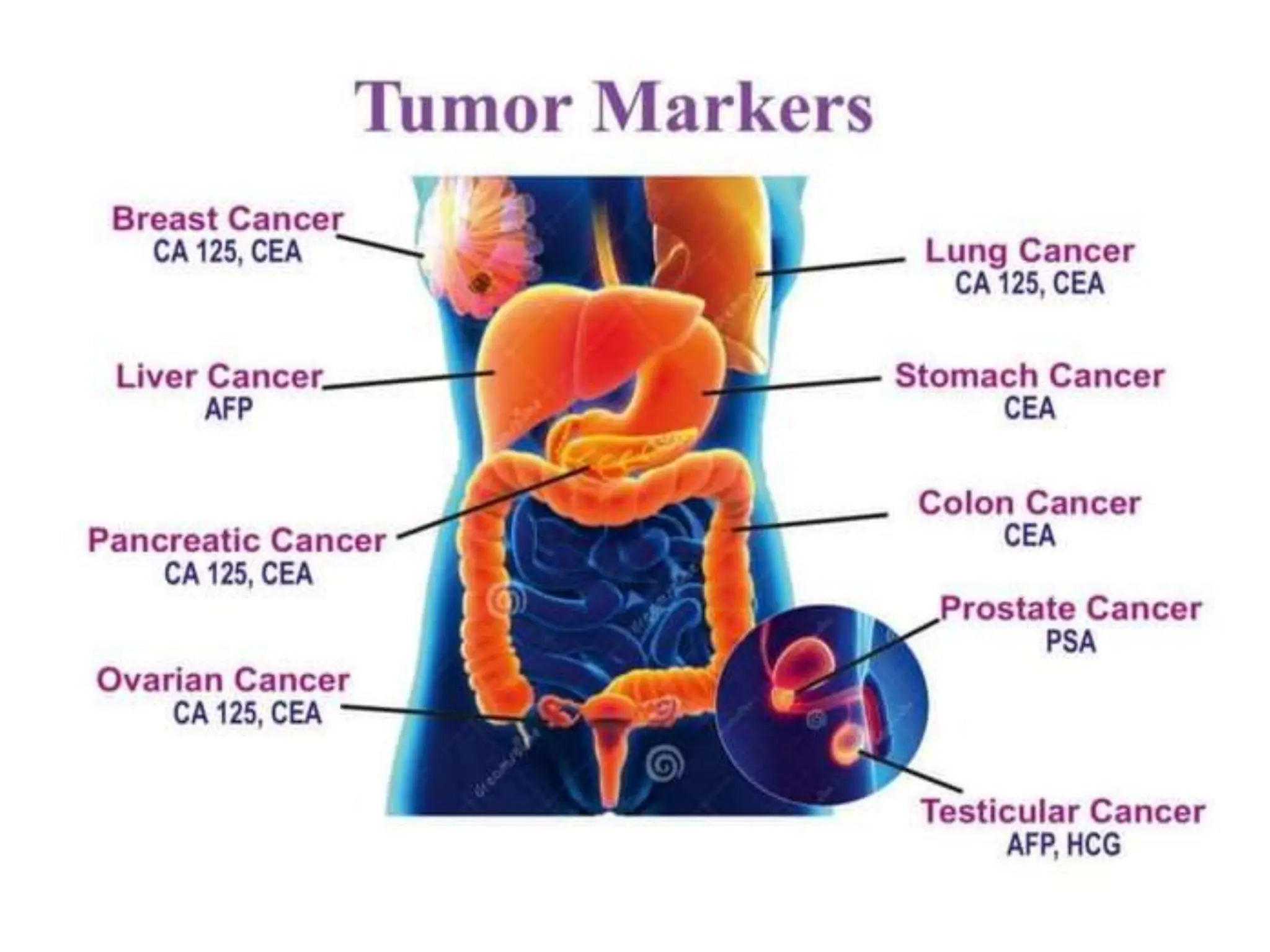 TUMOR MARKERS.-1.pptx by Aikoman radiology scientist at Catholic ...