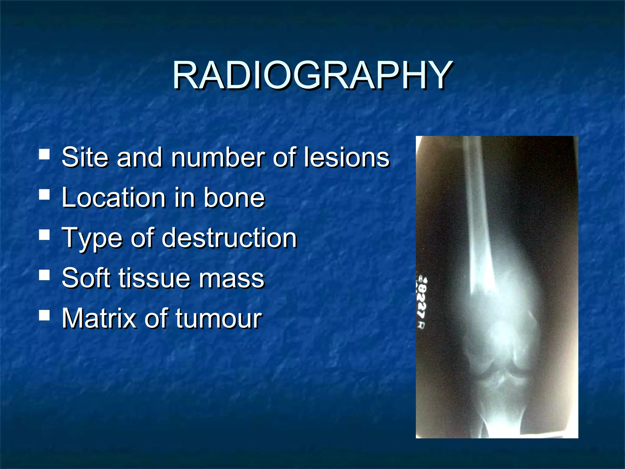 Tumor mega prosthesis | PPT
