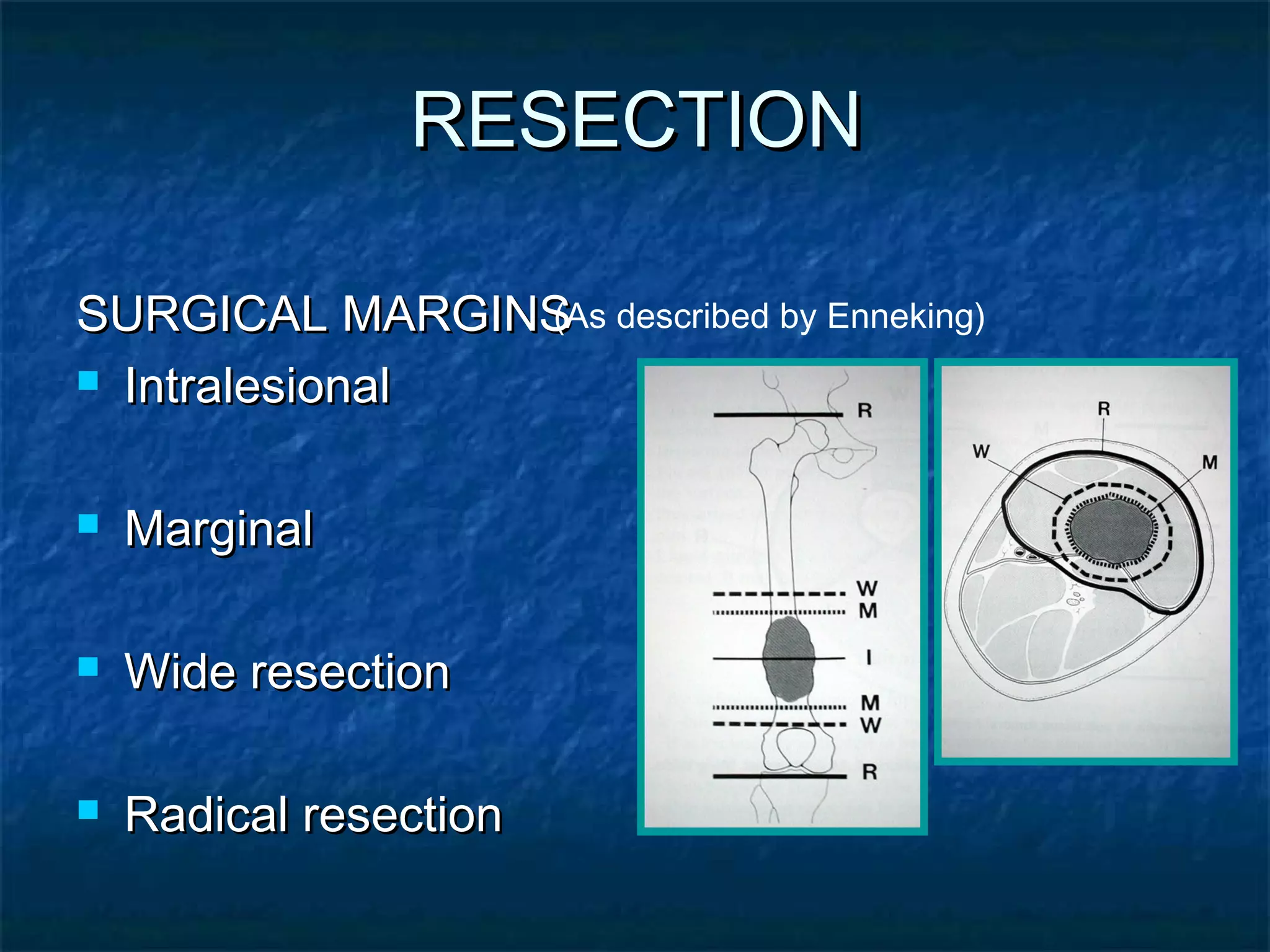 Tumor mega prosthesis | PPT