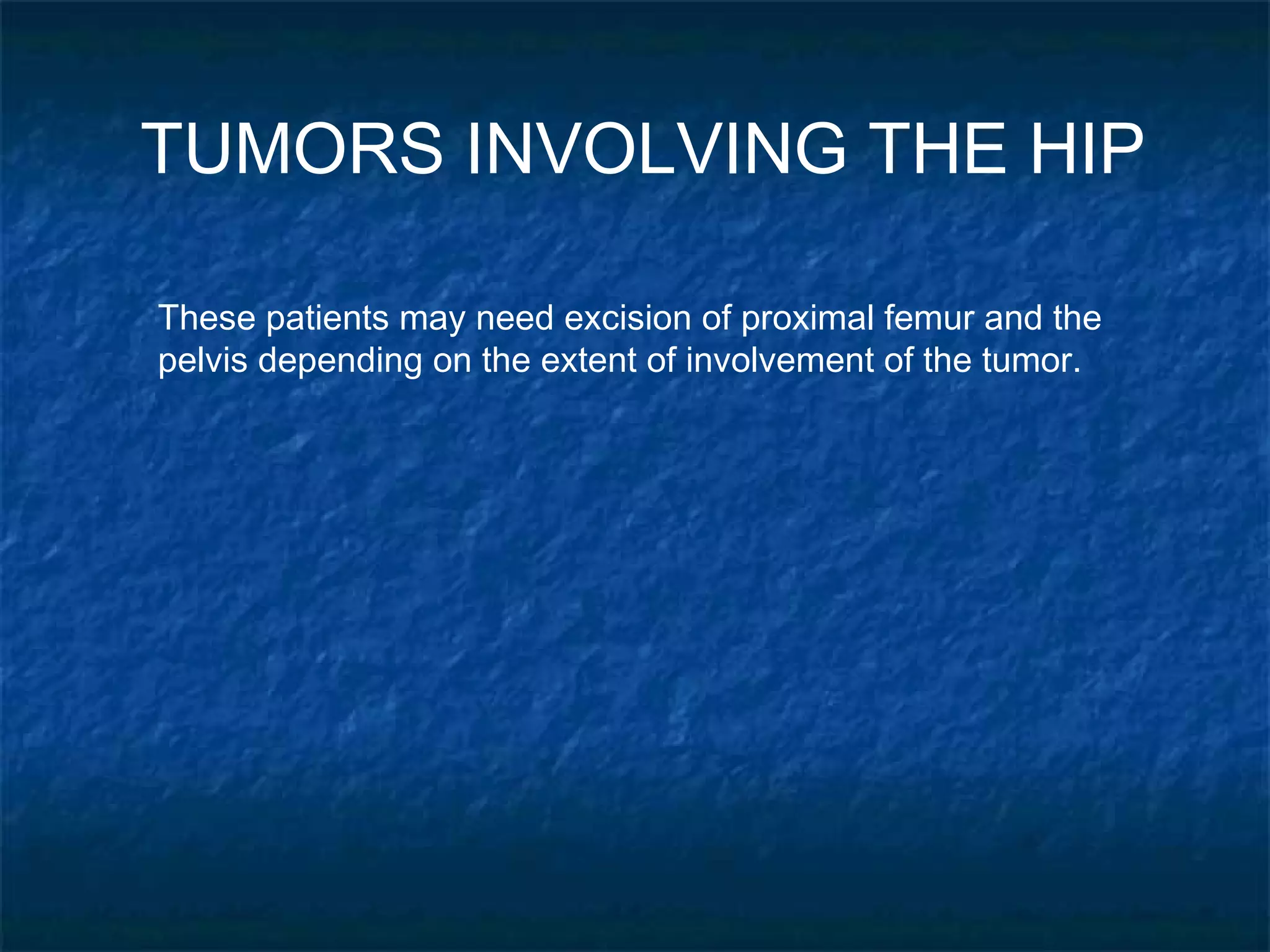 Tumor mega prosthesis | PPT