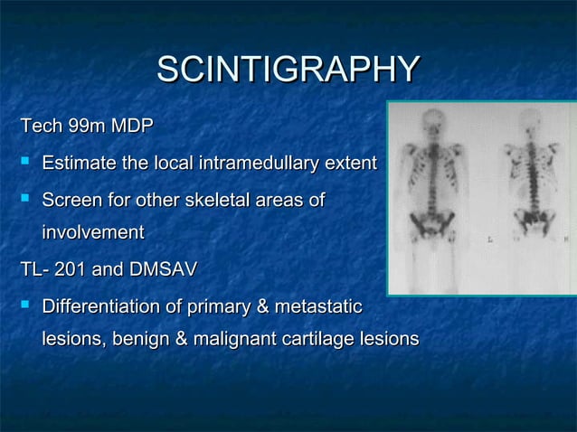 Tumor mega prosthesis | PPT
