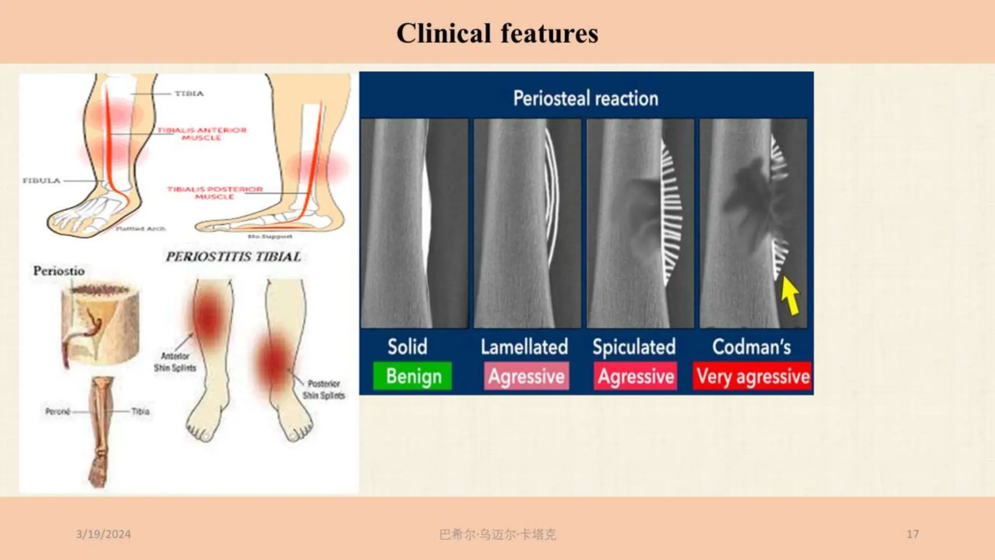 Tumor of lung and mediastinum By Baasir Umair khatak.pptx