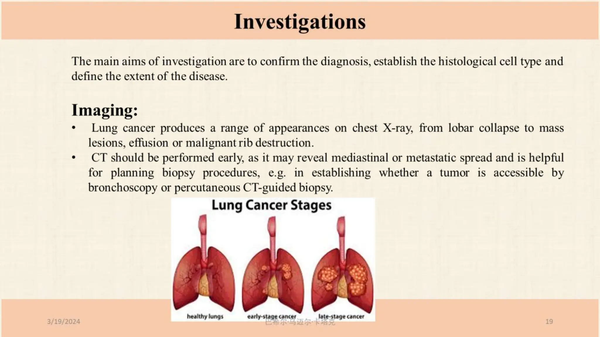 Tumor of lung and mediastinum By Baasir Umair khatak.pptx