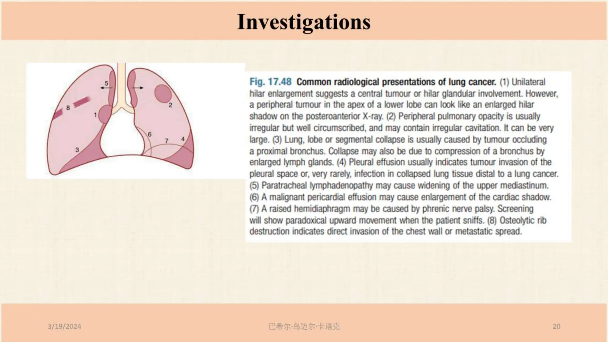 Tumor of lung and mediastinum By Baasir Umair khatak.pptx