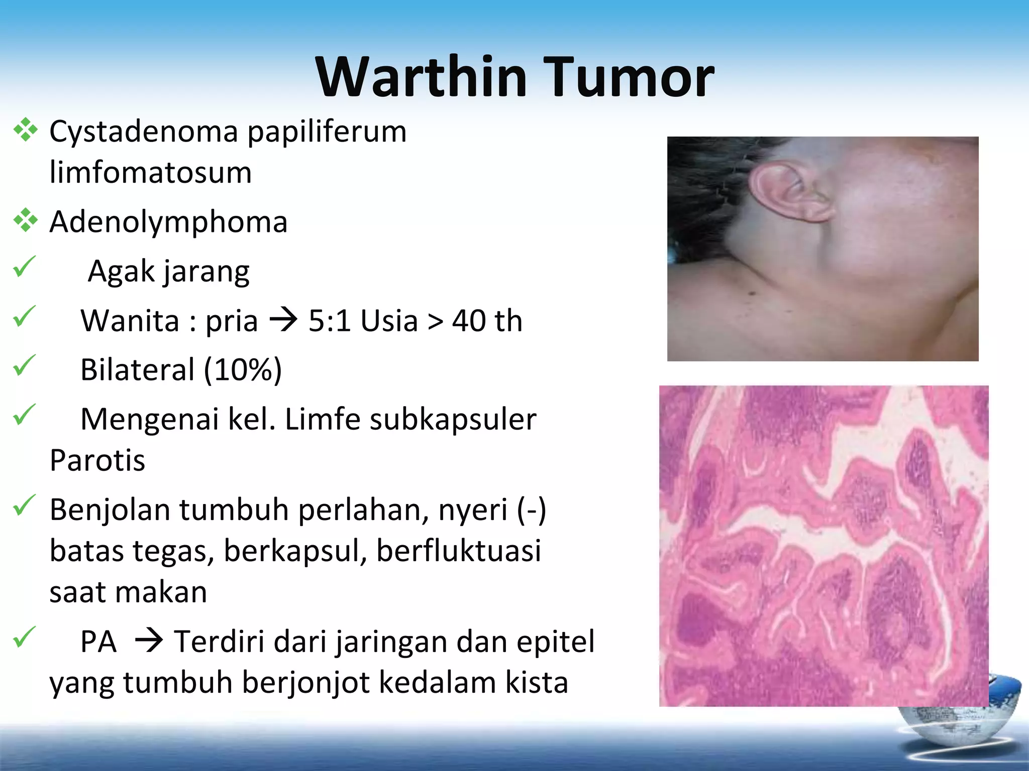 Tumor parotis ppt | PPTX