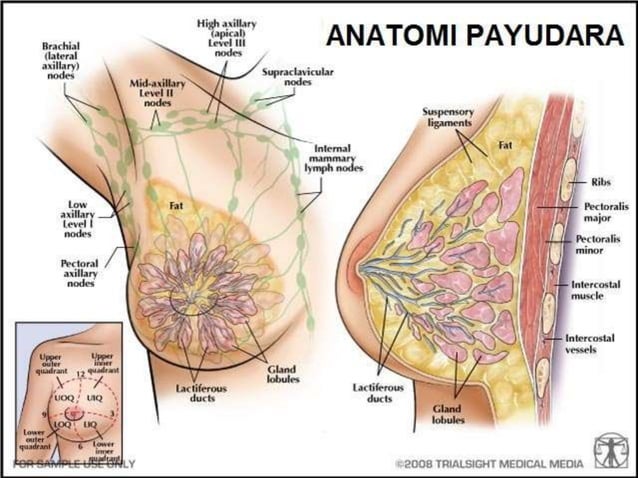 Tumor Payudara (1).ppt