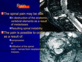 Metastatic Tumors of the Spinal Column: Diagnosis and Treatment | PPT