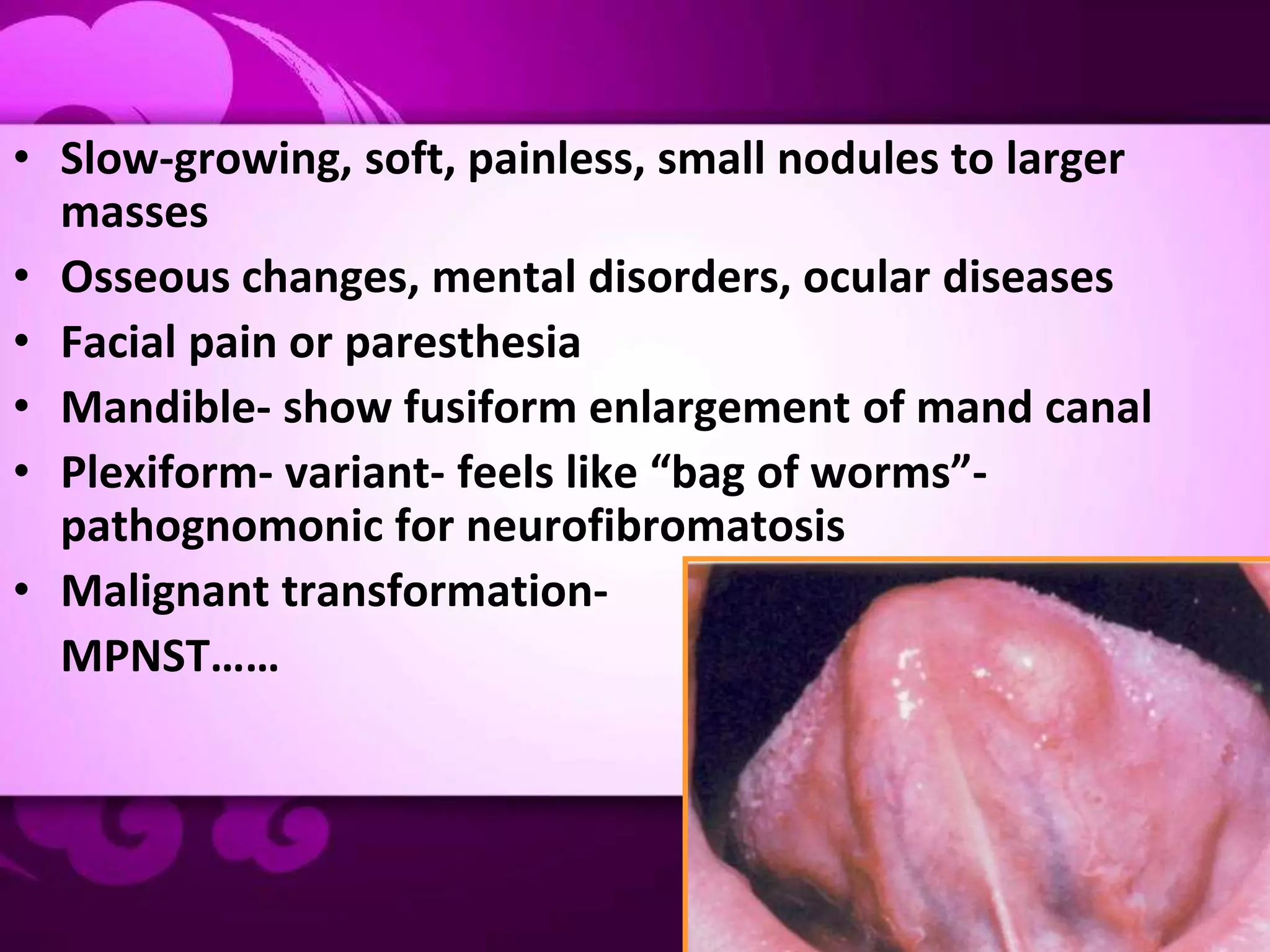 Tumors-of-nerves-and-muscles(Part-1)-2020819142700.pptx