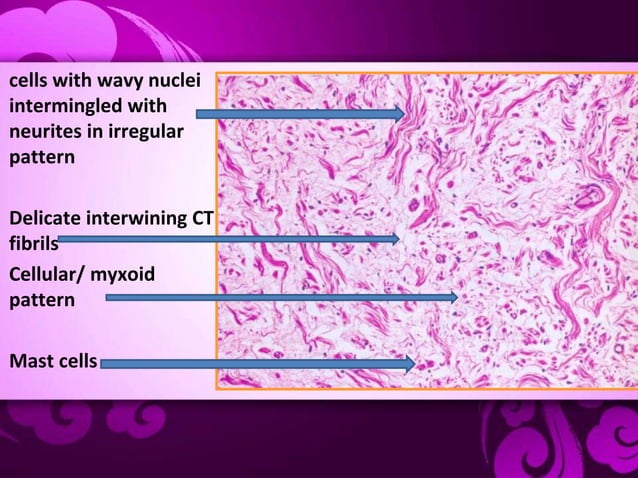 Tumors-of-nerves-and-muscles(Part-1)-2020819142700.pptx