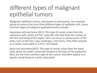 tumors.ppt