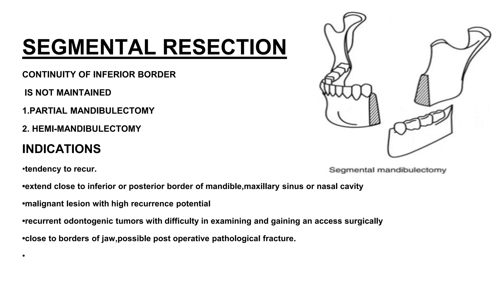 TUMORS of orofacial region special emphasis on management | PDF