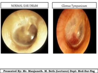 Tumors (ears) | PPTX