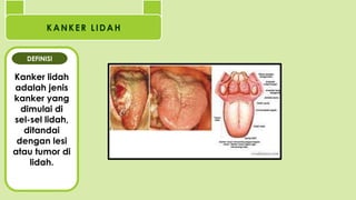 Tumor Sistem Pencernaan pada manusia.pptx
