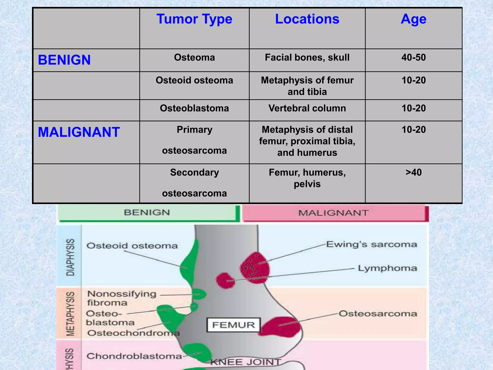 Tumors of bone | PPTX