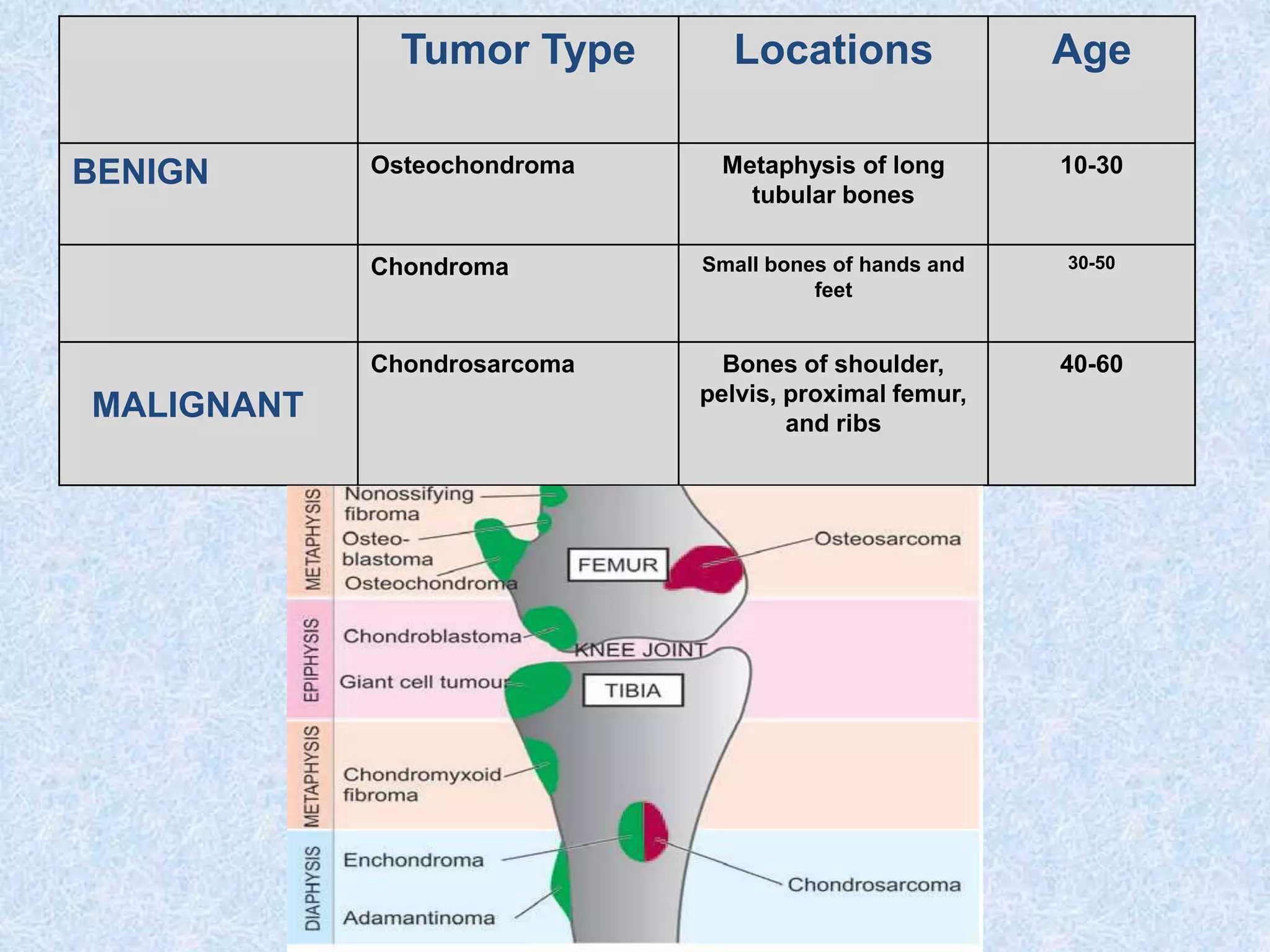 Tumors of bone | PPTX