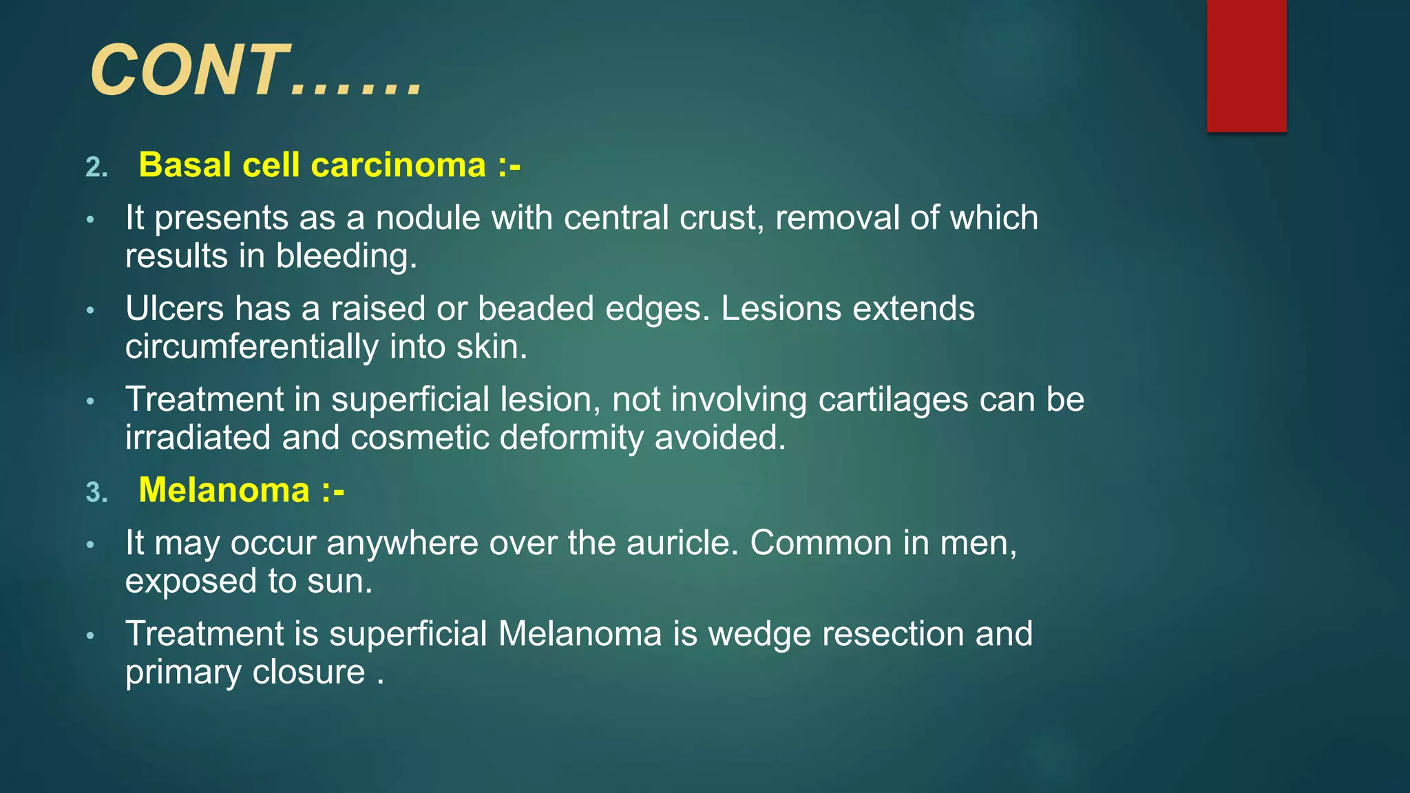Tumors Of Ear Ppt Free Download
