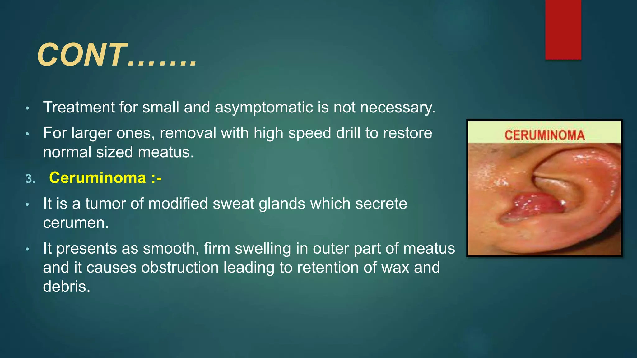 Tumors Of Ear Ppt