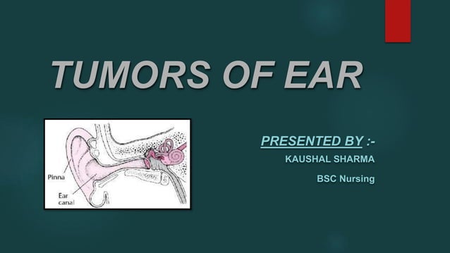 TUMORS OF EAR | PPTX