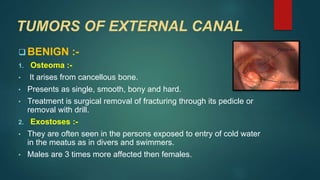 TUMORS OF EAR | PPTX