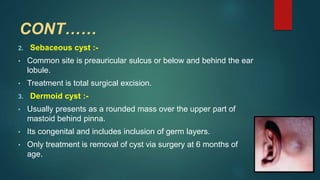 TUMORS OF EAR | PPTX