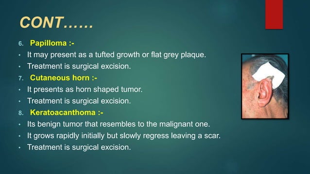 TUMORS OF EAR | PPTX