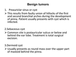 Tumors of ears.pptx