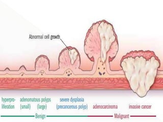 Tumors of Epithelial Tissue | PPTX