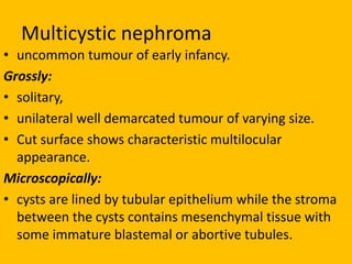 Tumors of kidney | PPTX
