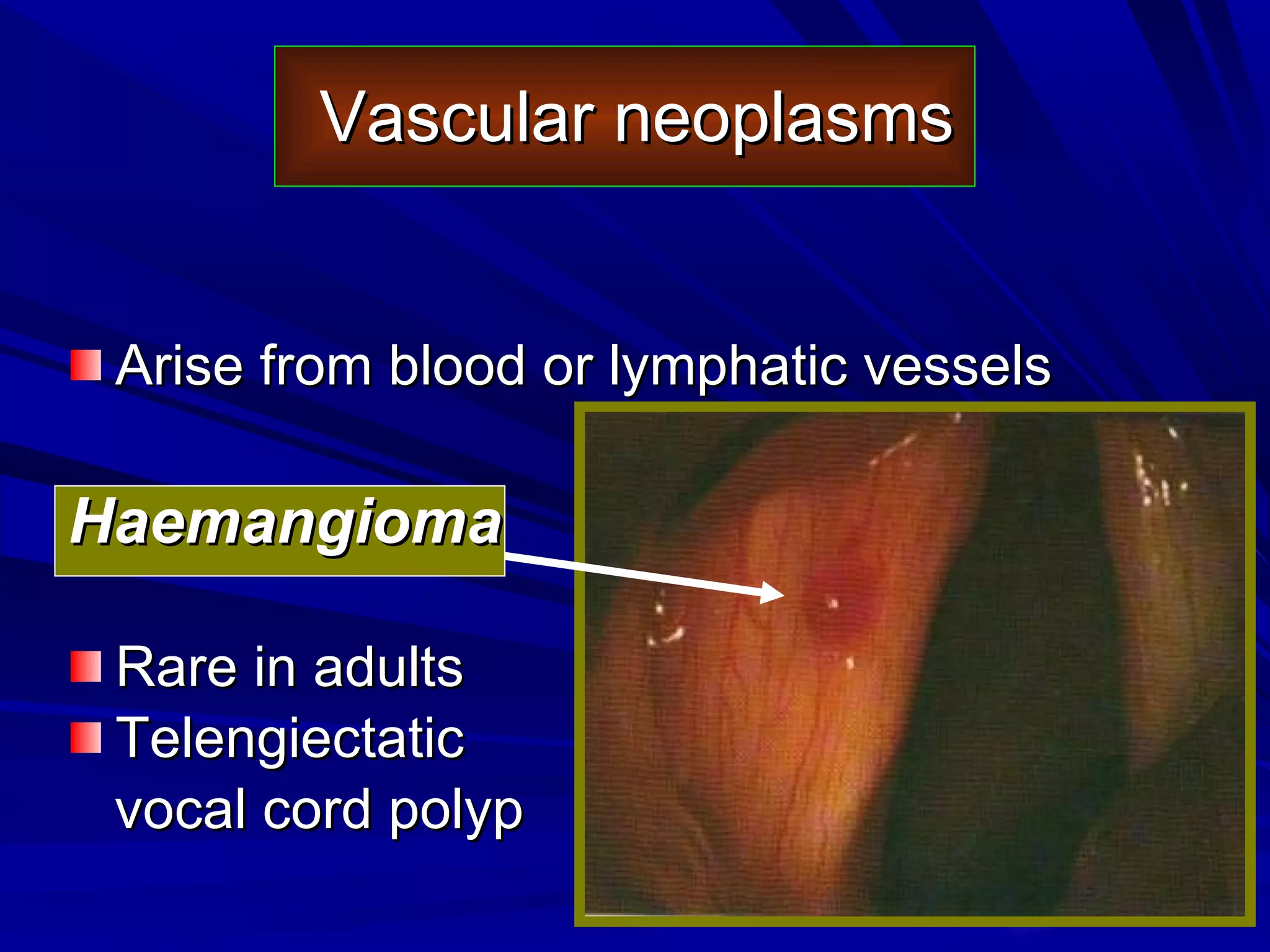 E.N.T,Tumors of larynx.(dr.usif chalabe) | PPT | Ear, Nose and Throat ...