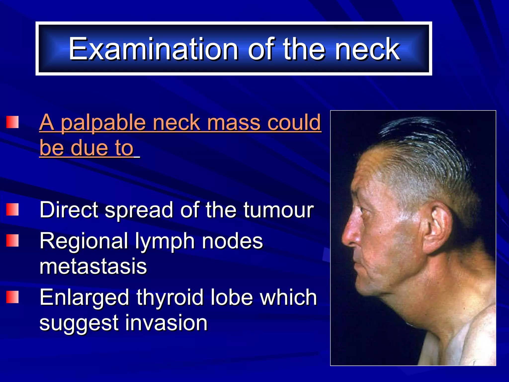 E.N.T,Tumors of larynx.(dr.usif chalabe) | PPT | Ear, Nose and Throat ...