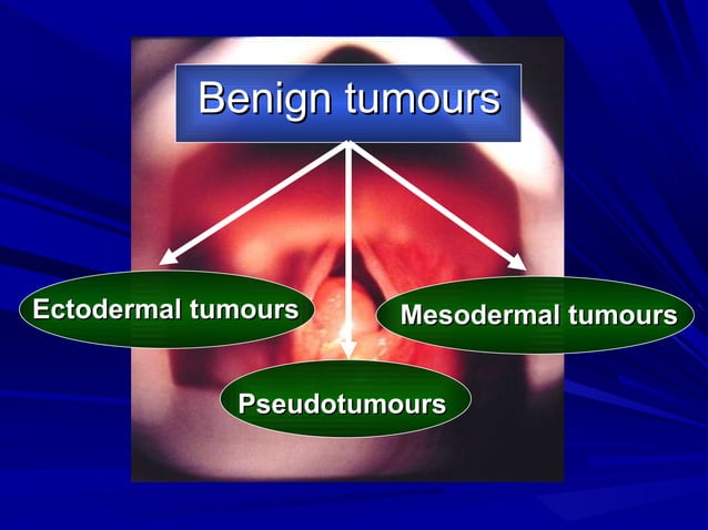 E.N.T,Tumors of larynx.(dr.usif chalabe) | PPT | Ear, Nose and Throat ...