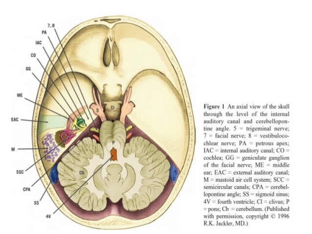 Benign Ear Tumors
