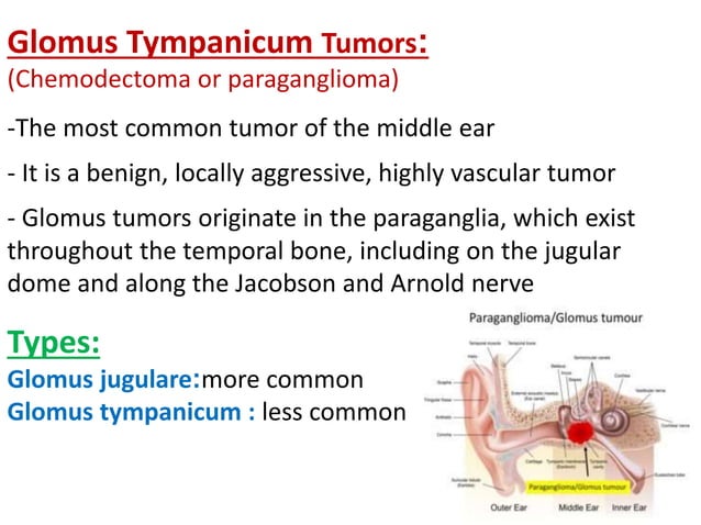 Tumors of middle ear.pptx