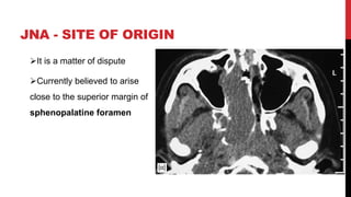 TUMORS OF NASOPHARYNX,etiology ,pathology ,treatment | PPTX