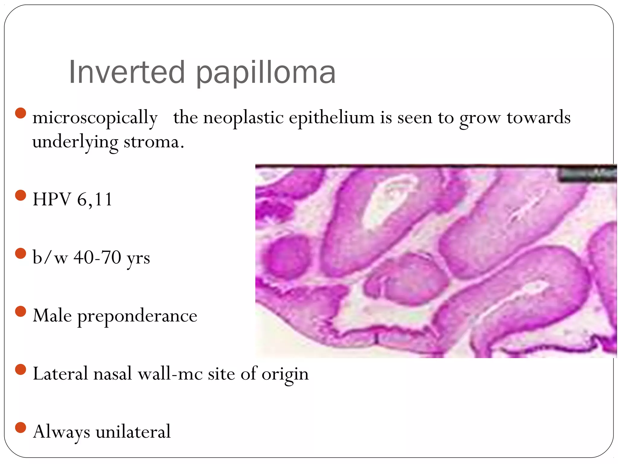 Tumors of nose and paranasal sinus dr.sithanandhakumar -13.06.16