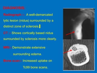 Tumors of osseous origin | PPT