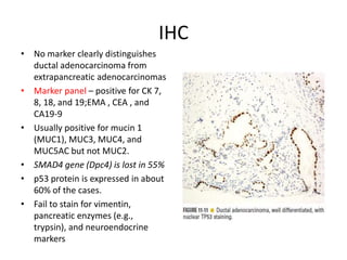 Tumors of pancreas | PPTX