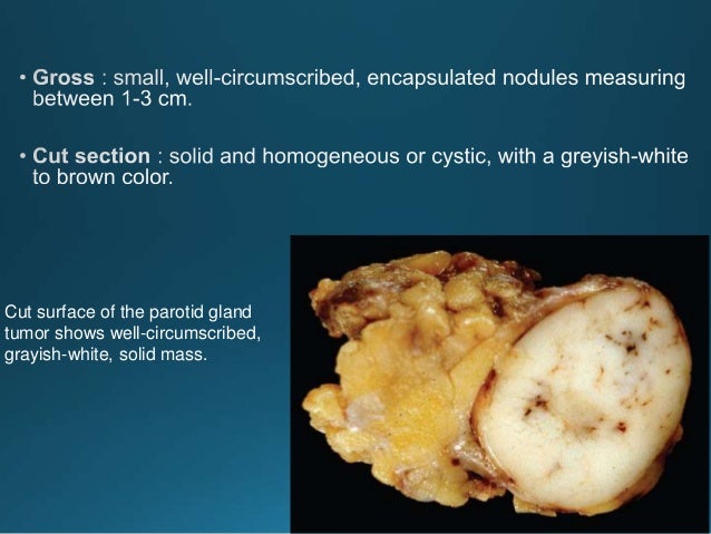 Tumors of salivary gland