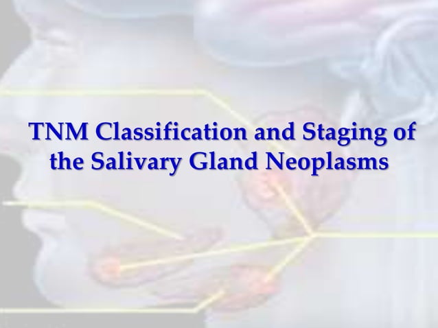 Tumors of salivary glands | PPTX
