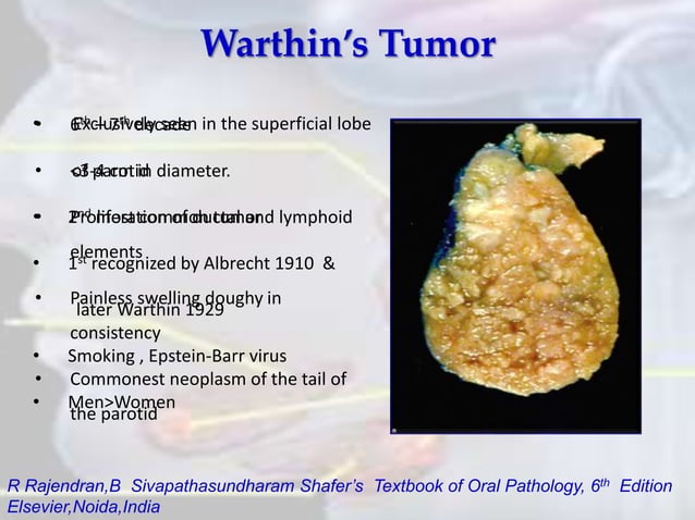 Tumors of salivary glands | PPTX