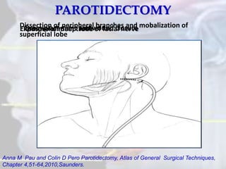 Tumors of salivary glands | PPTX