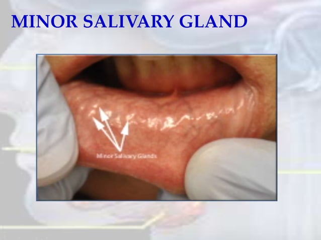 Tumors of salivary glands | PPTX