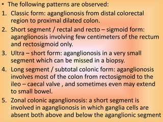 Tumors of small intestine | PPTX