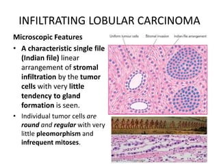 Tumors of the breast | PPTX