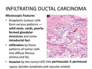 Tumors of the breast | PPTX