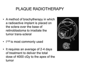 Tumors of the eye | PPT